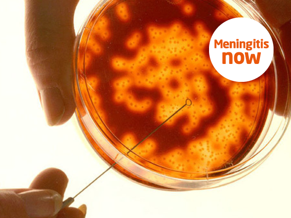 Types and Causes of meningitis | Meningitis Now